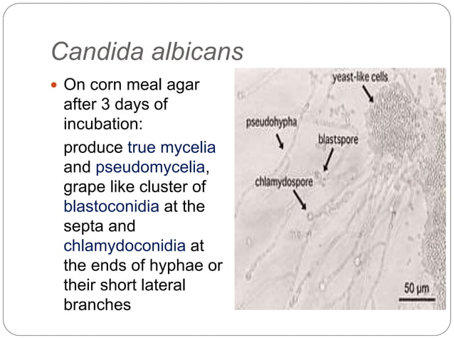 Candida | PPTX | Skin and Dermatology | Diseases and Conditions
