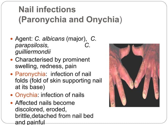 Candida | PPTX | Skin and Dermatology | Diseases and Conditions