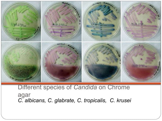 Candida | PPTX | Skin and Dermatology | Diseases and Conditions