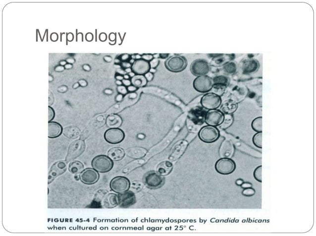 Candida | PPTX | Skin and Dermatology | Diseases and Conditions