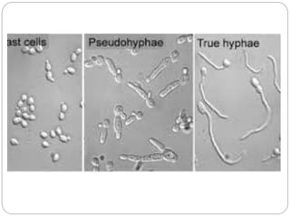 Candida In Urine