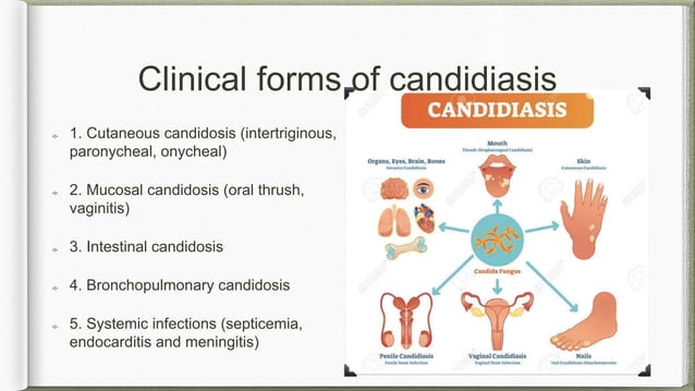 Candida.pptx