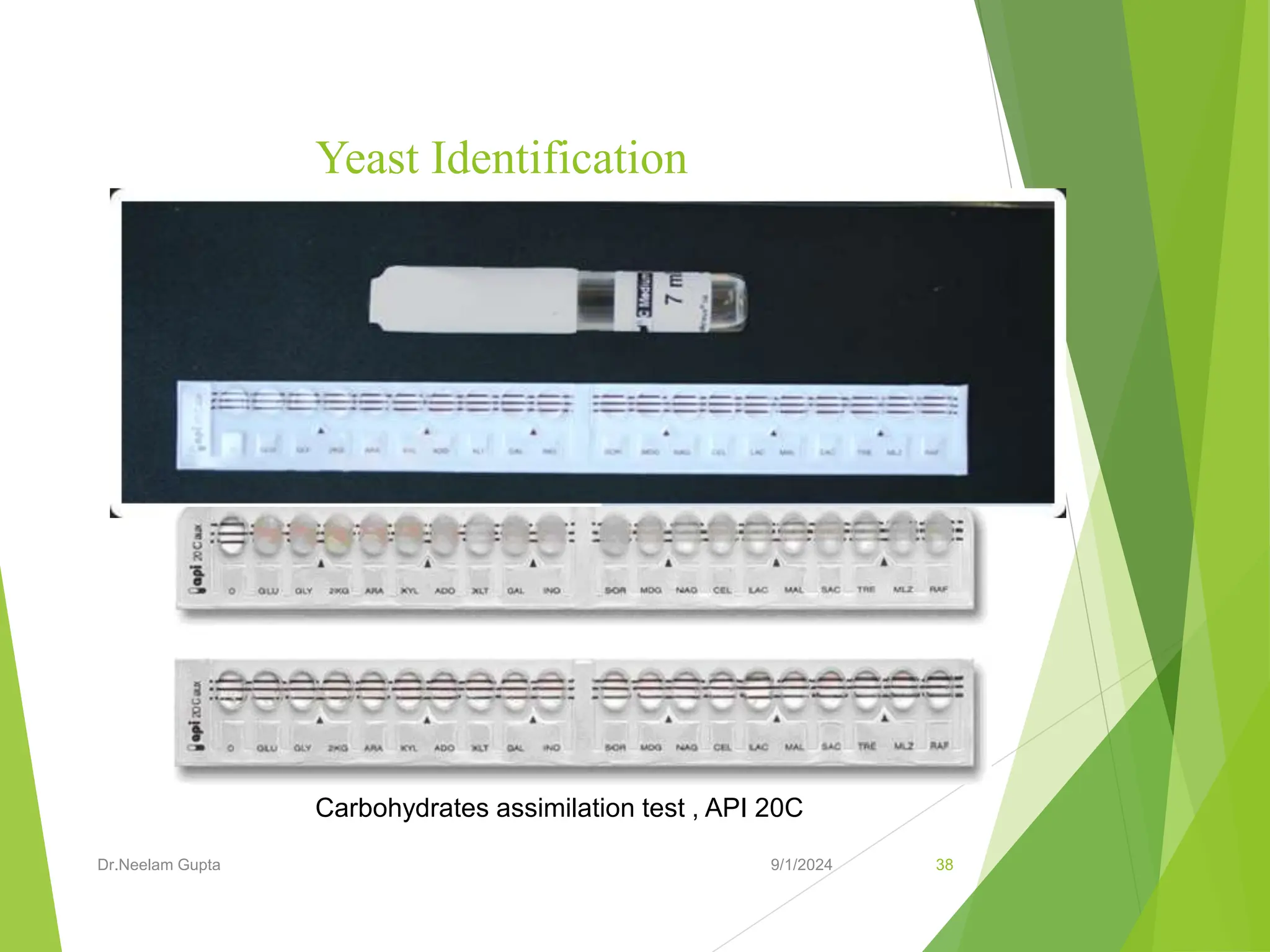 YEAST-CANDIDIASIS WITH LABORATORY DIAGNOSIS .pptx