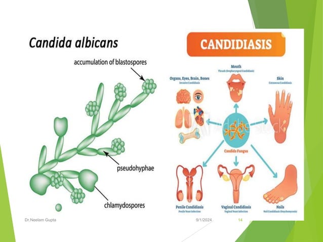 YEAST-CANDIDIASIS WITH LABORATORY DIAGNOSIS .pptx