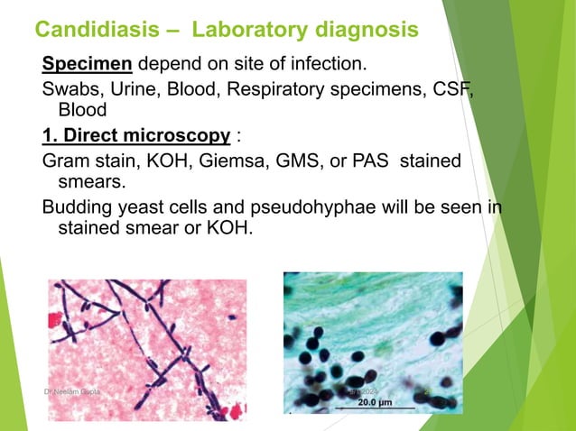 YEAST-CANDIDIASIS WITH LABORATORY DIAGNOSIS .pptx