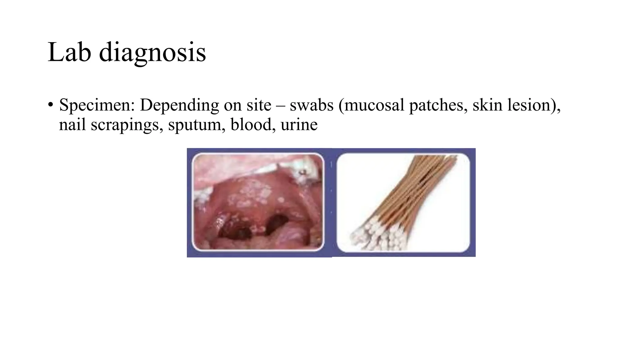 Candida oral pathology. .pptx