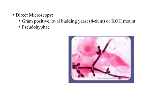 Candida oral pathology. .pptx