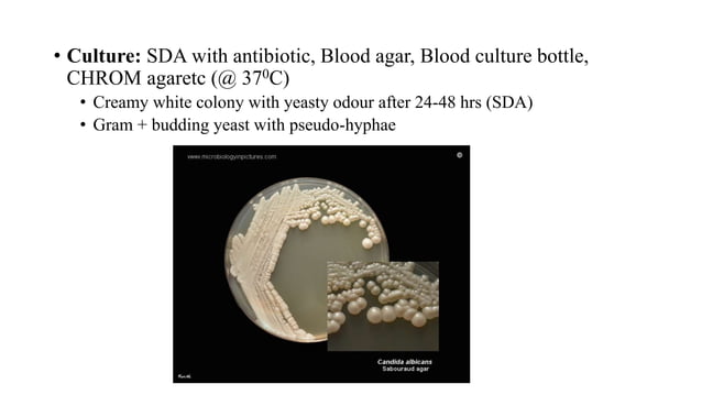 Candida oral pathology. .pptx