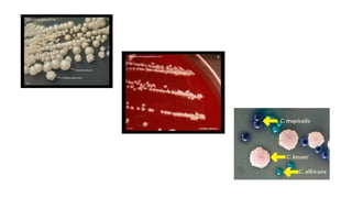 Candida oral pathology. .pptx