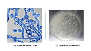 Candida albicans - opportunistic mycoses.pptx