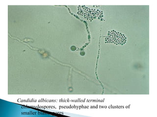 Diagnosis of Candida albicans infection in animals | PPT