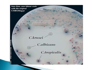 Diagnosis of Candida albicans infection in animals | PPT