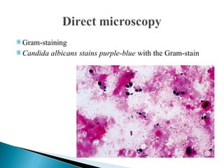 Diagnosis of Candida albicans infection in animals | PPT