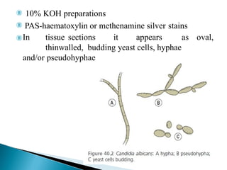 Diagnosis of Candida albicans infection in animals | PPT