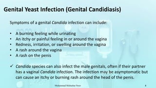 Candida albicans | PPTX