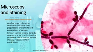 Candida Albicans Microscope Slide