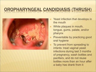 Candida Albicans.ppt