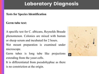 Medically Important Candida albicans.pptx