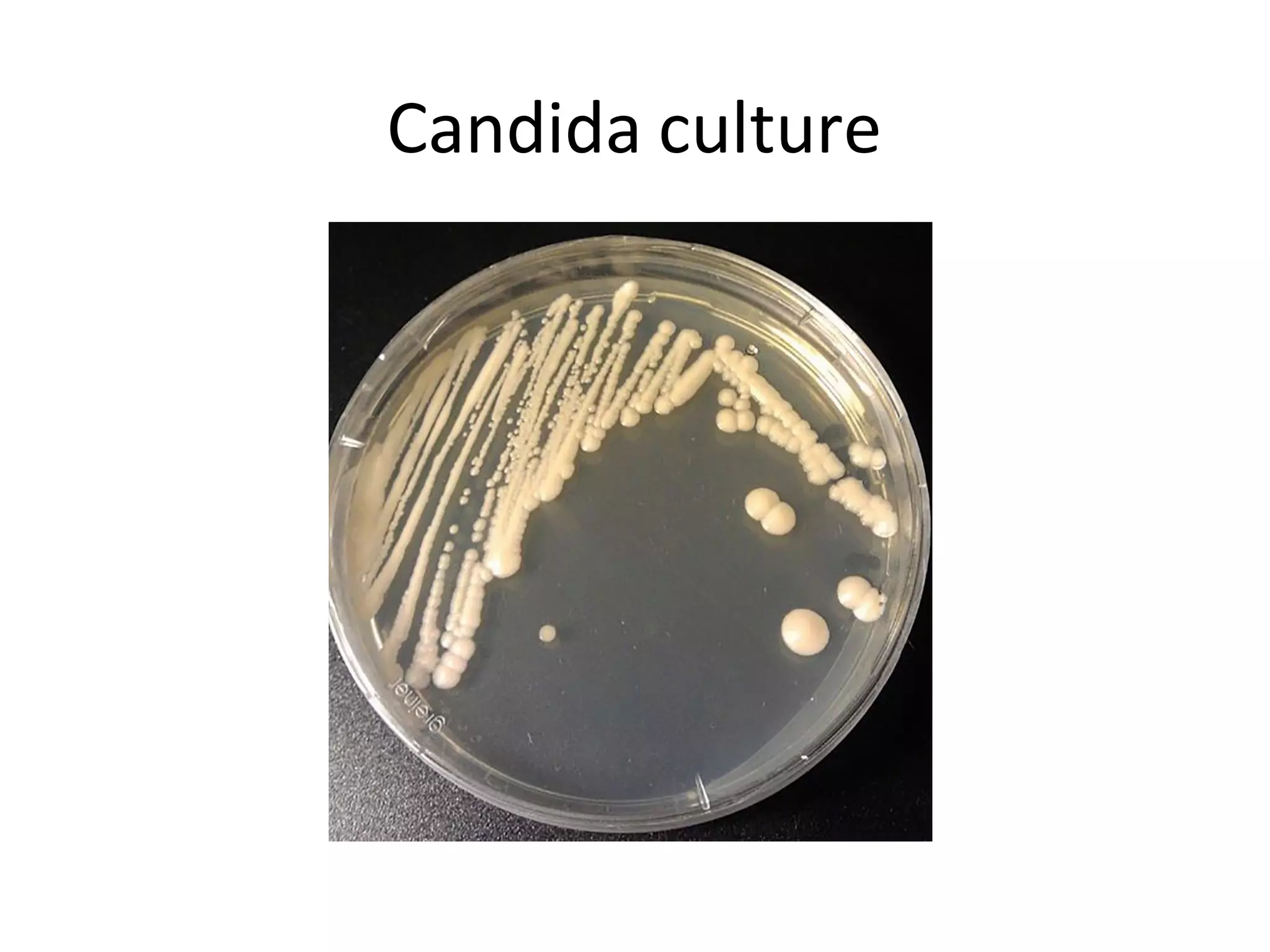candida albicans (1).pdf