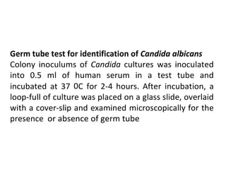 candida albicans (1).pdf