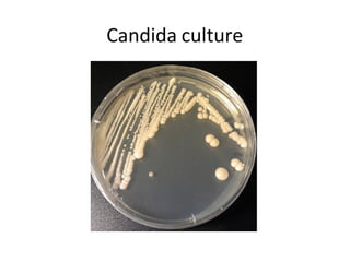 candida albicans (1).pdf