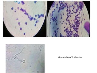 candida albicans (1).pdf