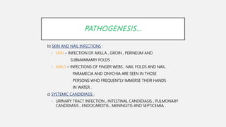 CANDIDA ALBICANS ( Candidiasis ) | PPTX