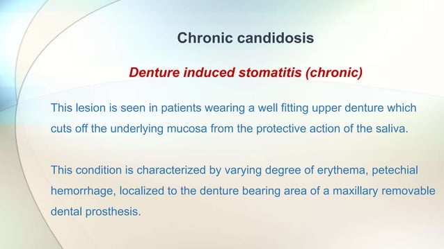 candidal infection.pptx