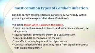 candidal infection.pptx