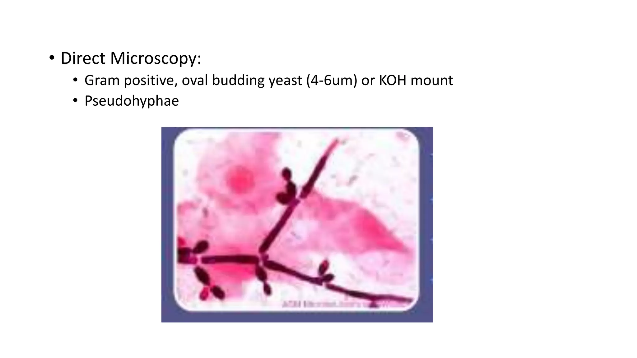 Candida pathogen.pptx | Skin and Dermatology | Diseases and Conditions