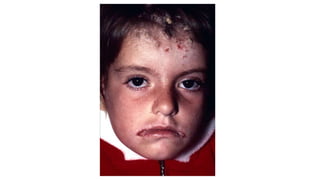 Candida pathogen.pptx