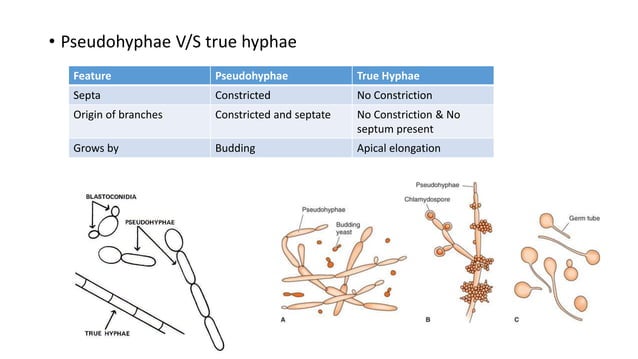 Candida pathogen.pptx | Skin and Dermatology | Diseases and Conditions