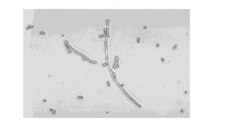 Candida pathogen.pptx