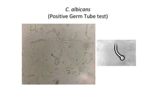 Candida pathogen.pptx