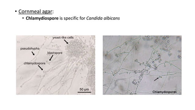 Candida pathogen.pptx | Skin and Dermatology | Diseases and Conditions