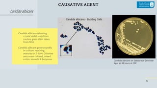 Candidasis infection | PPT