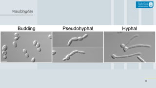 Candidasis infection | PPT