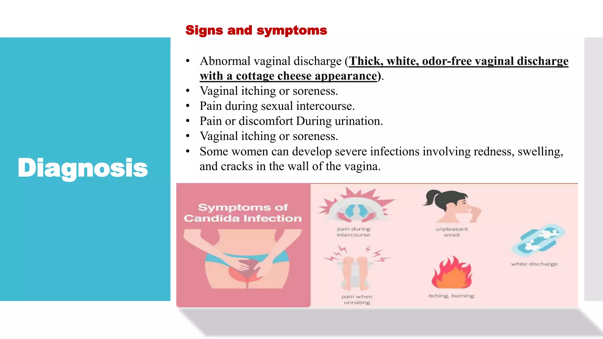 candidasis ( monilia vaginitis).pptx