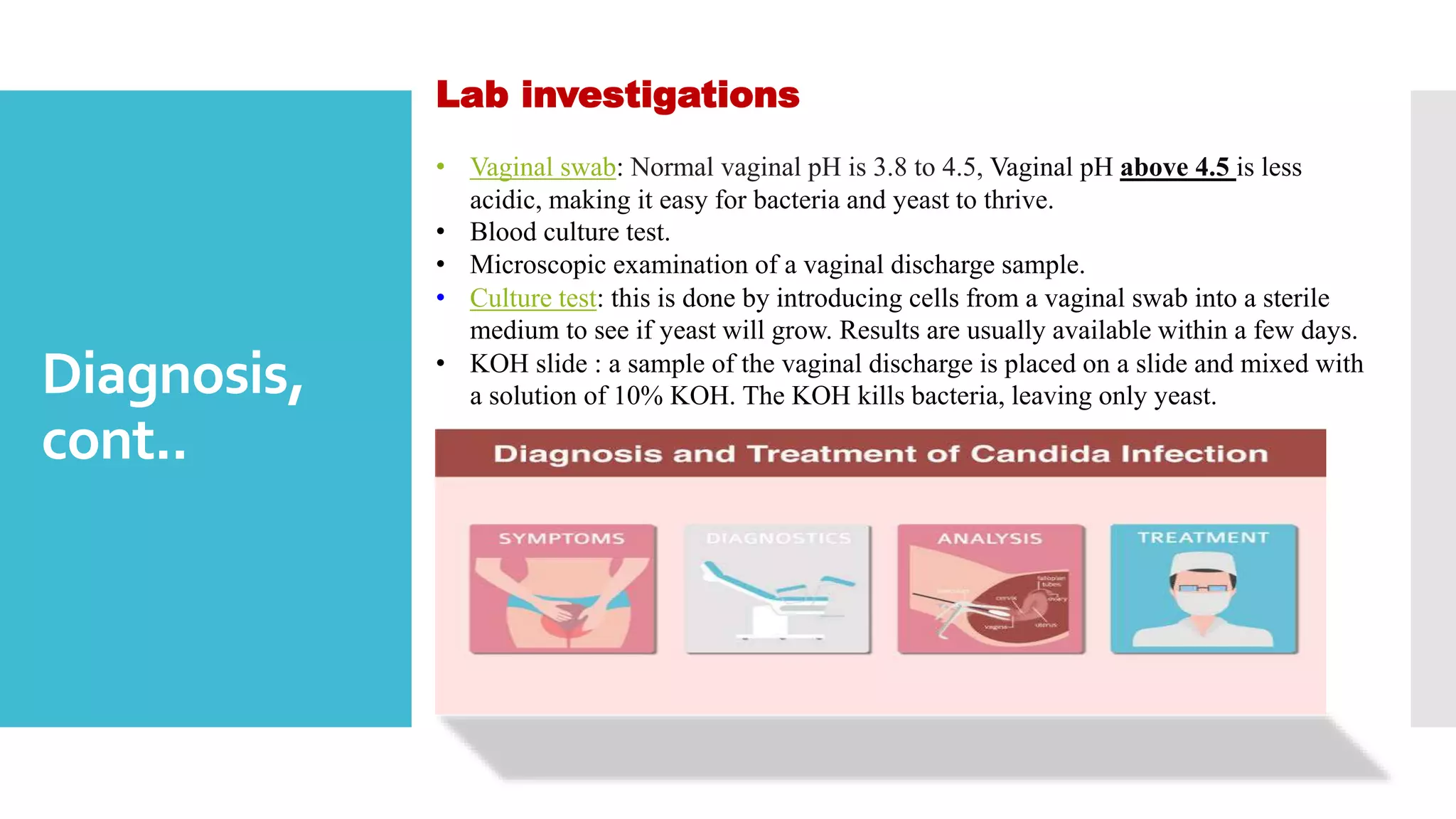 candidasis ( monilia vaginitis).pptx