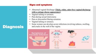 candidasis ( monilia vaginitis).pptx