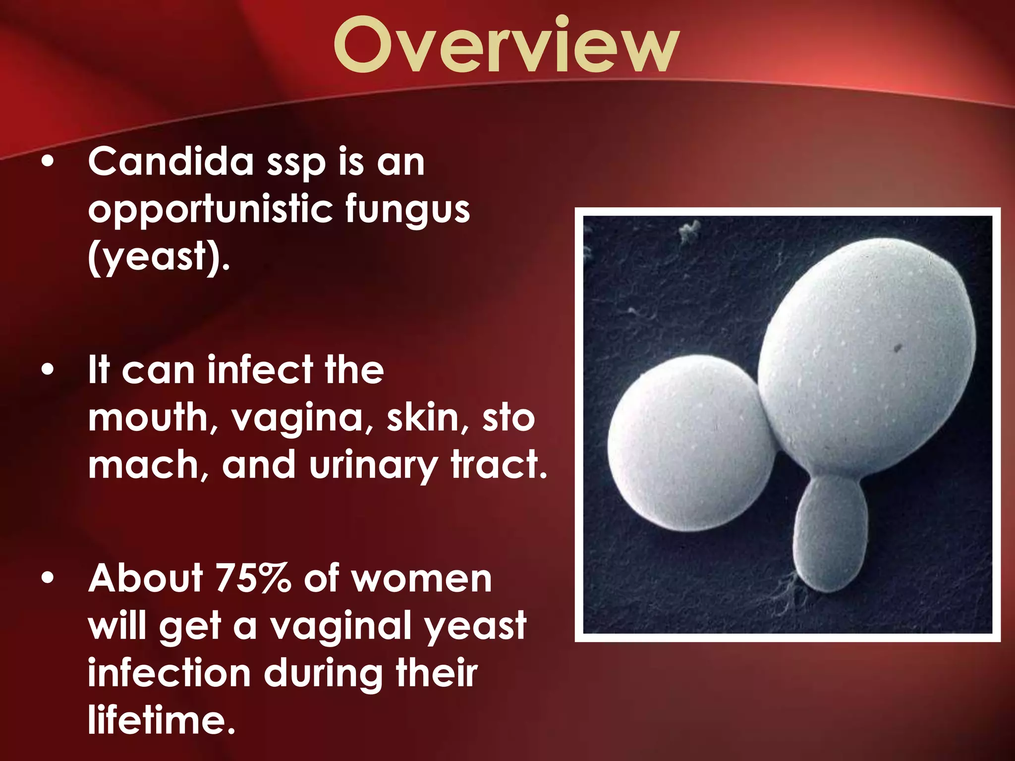 Candidiasis | PPTX