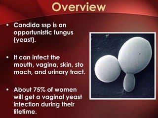 Candidiasis | PPTX
