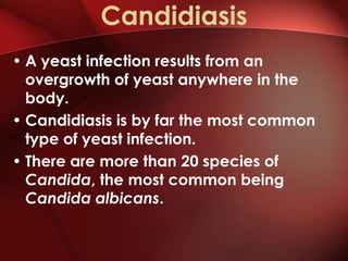 Candidiasis | PPTX
