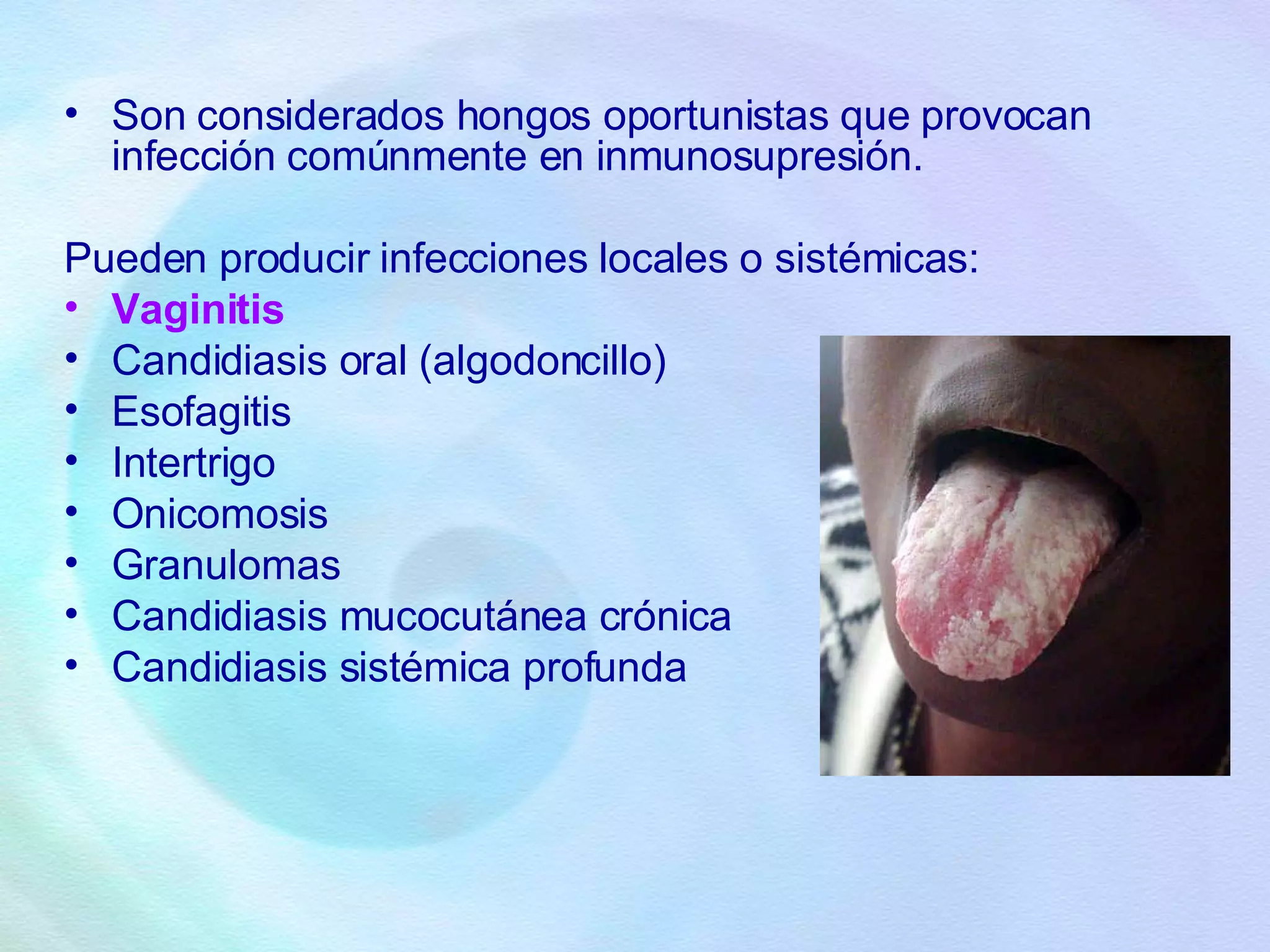 Candidiasis | PPT | Medical Health