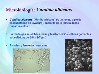 Candidiasis | PPT