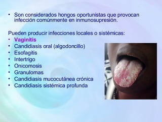 Candidiasis | PPT