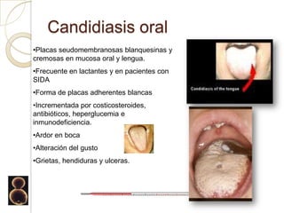 Candidiasis | PPT