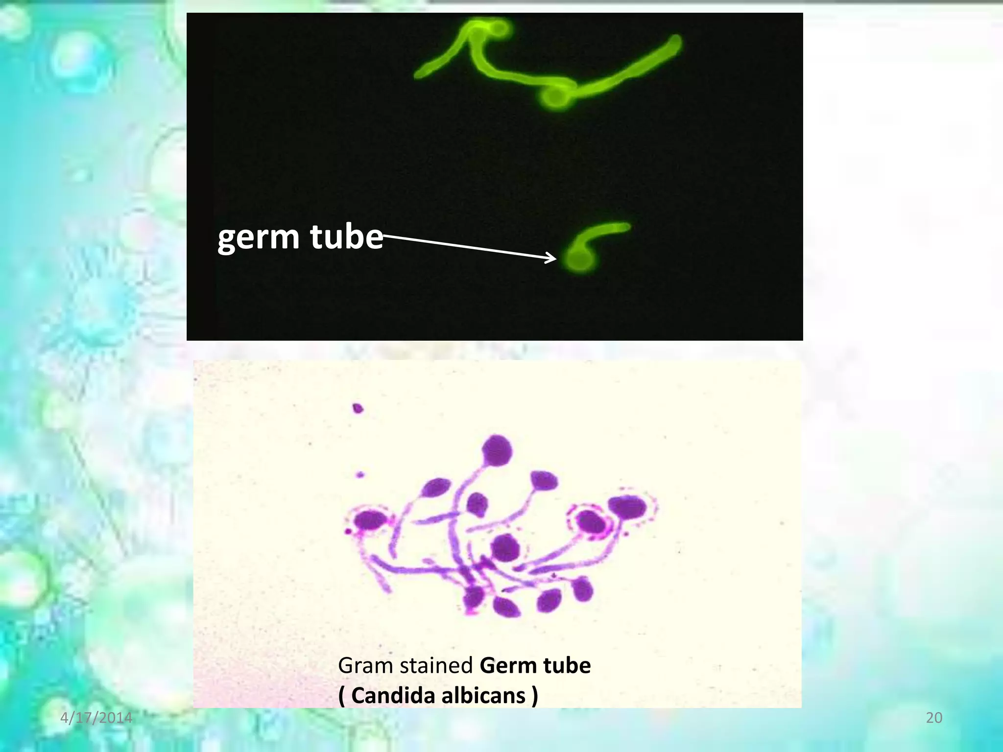 Candidiasis, Moniliasis, Oral thrush, Yeast infections | PPT