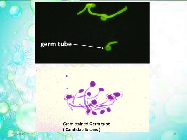 Candidiasis, Moniliasis, Oral thrush, Yeast infections | PPT