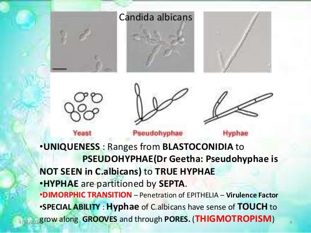 Candidiasis, Moniliasis, Oral thrush, Yeast infections
